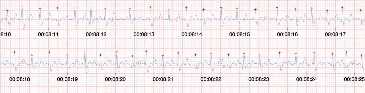 ECG of the athletic horse - Training solutions
