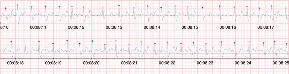ECG of the athletic horse - Training solutions