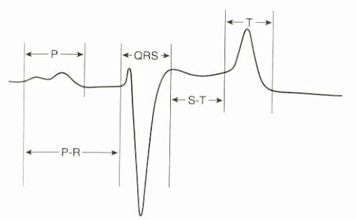 ECG of the athletic horse - Training solutions